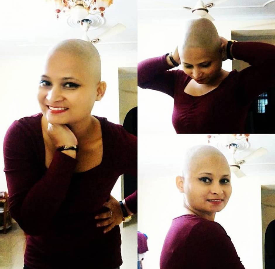 Being bald and bold